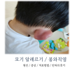 아기 모기 알레르기 아기 모스키토 증후군 상태 및 치료법 아기 귀 부음 봉와직염 네이버 블로그