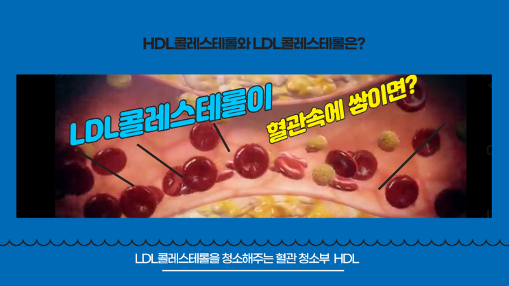 좋은 Hdl 나쁜 Ldl 콜레스테롤 역할 정상수치 여성호르몬과의관계 네이버 블로그