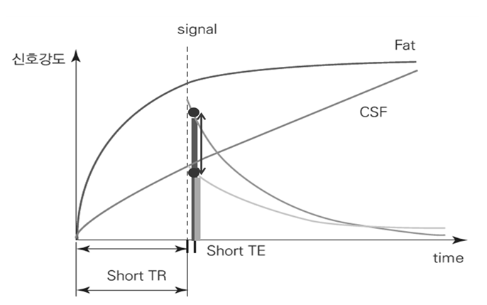 MRI medical physics (T1, T2, PD 강조영상) : 네이버 블로그