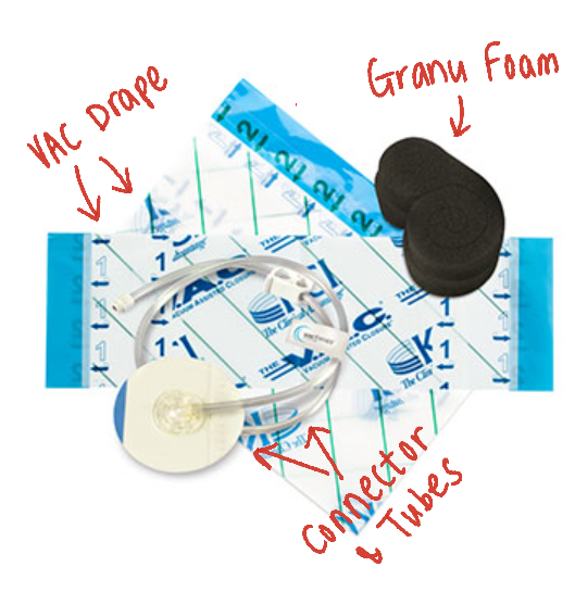 호주 간호사 민재 | VAC Dressing (Vacuum-assisted closure), Negative Pressure ...