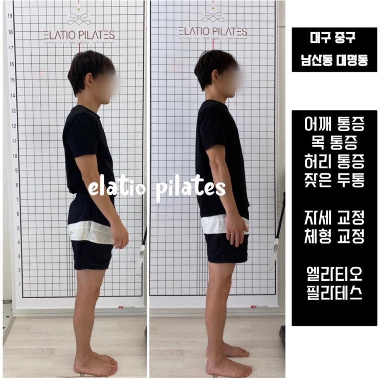 대구 어깨 통증 어깨 재활 운동 어깨 충돌 증후군 회전근개 파열 오십견 재활필라테스 중구 남산동 대명동 엘라티오
