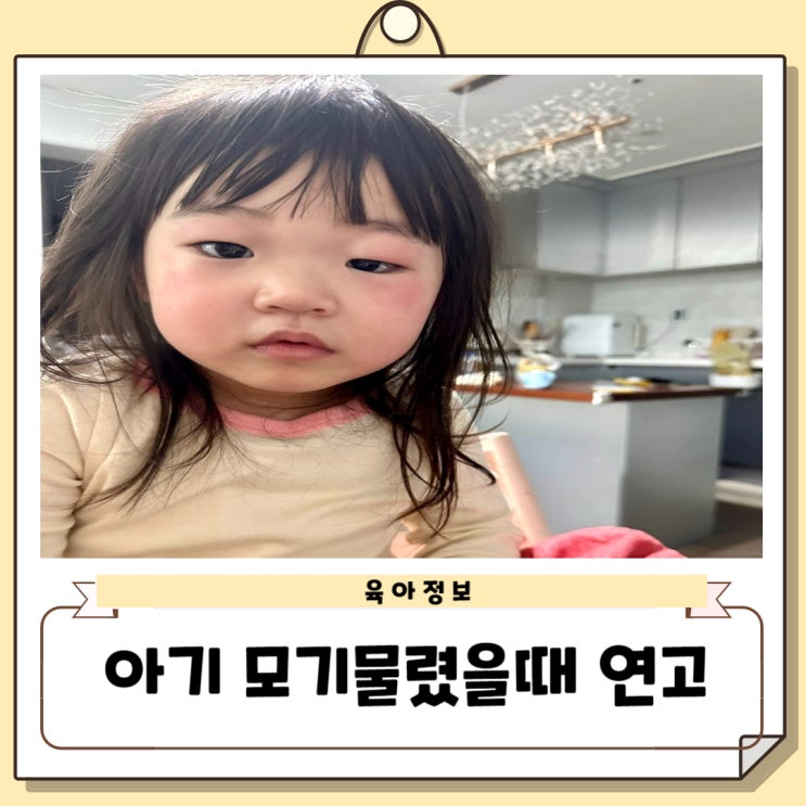 아기 모기물렸을 때 아기모기리도맥스 리도스타 에스로반 연고종류 : 네이버 블로그