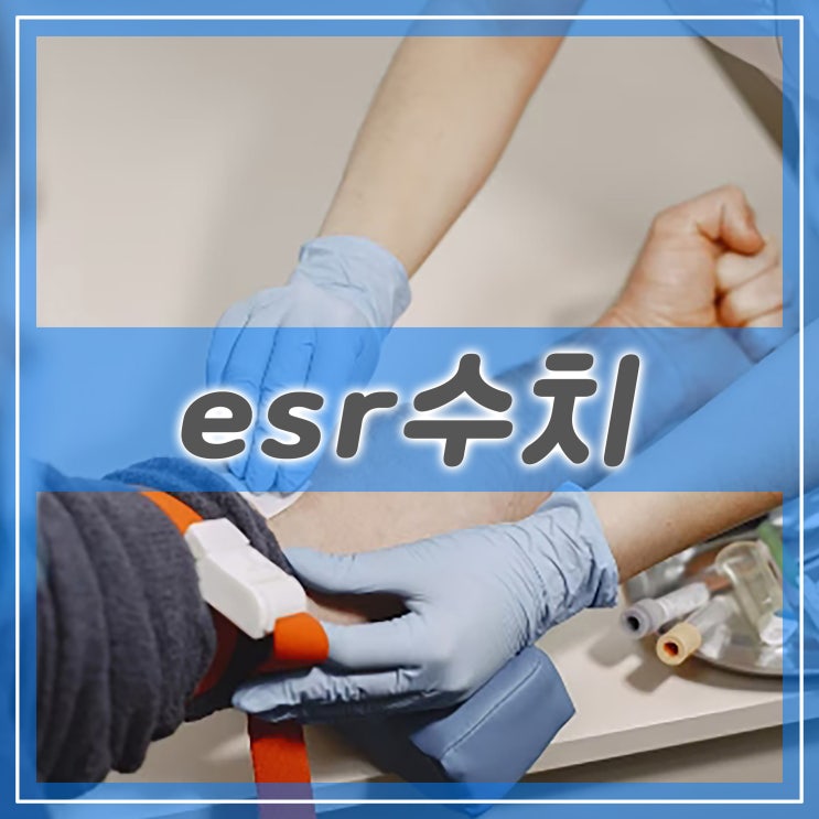 esr 수치 검사 혈구침강속도를 통한 혈액 염증 확인 : 네이버 블로그