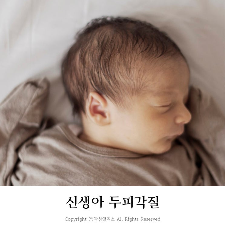 신생아 두피각질 머리딱지 아기 머리각질 두피지루성피부염 관리 네이버 블로그