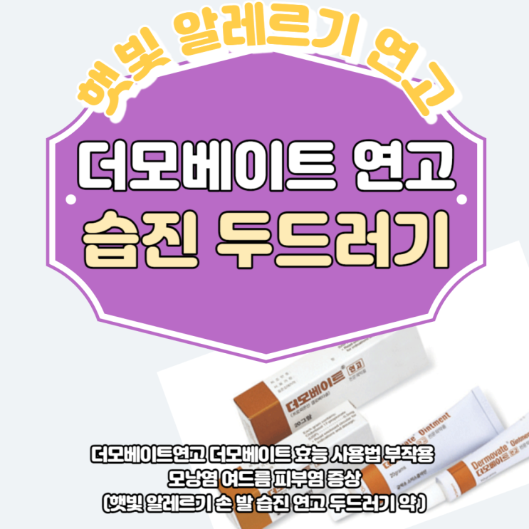 더모베이트연고 더모베이트 효능 사용법 부작용 모낭염 여드름 피부염 증상햇빛 알레르기 손 발 습진 연고 두드러기 약