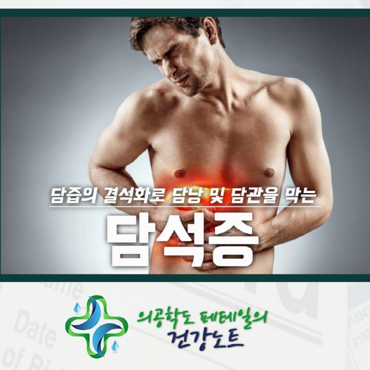 간내 담관 담낭에 결석이 발생하여 폐색으로 인해 문제가 되는 간 질환 담석증 정의 원인 증상 진단 치료