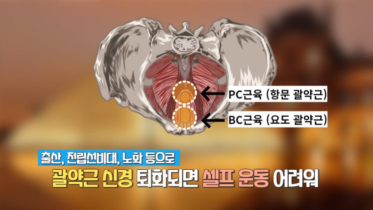 케겔운동 방법 잘못하면 효과 없어요 : 네이버 블로그