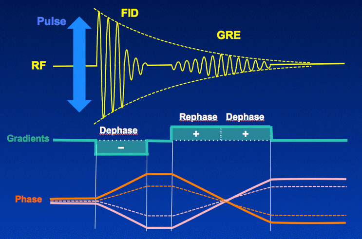 MRI pulse sequence 3. Gradient echo : 네이버 블로그