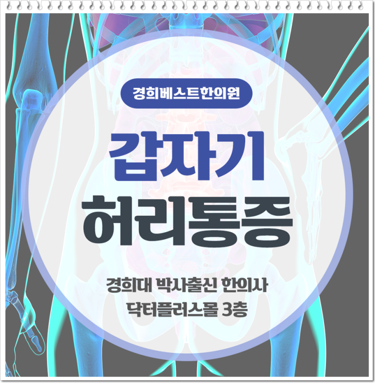 갑자기 허리통증 명절 급성요추염좌 어떻게 치료할까 네이버 블로그
