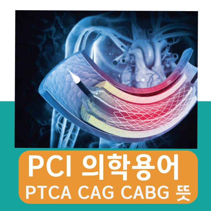 PCI 의학용어 경피적관상동맥중재술 PTCA CAG CABG : 네이버 블로그