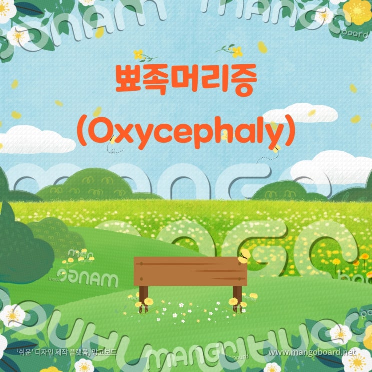 뾰족머리증(Oxycephaly) : 네이버 블로그