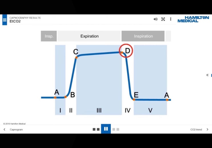 EtCO2 (Capnography 호기말 이산화탄소 분압) 공부하기 : 네이버 블로그