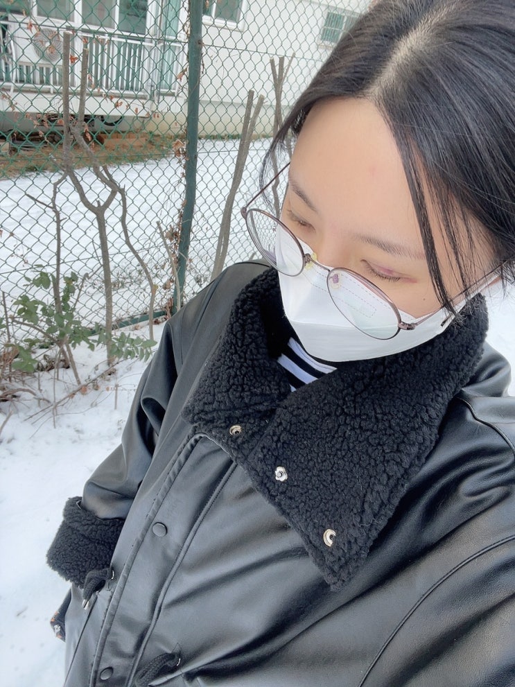 아이라인 반영구 제거 아이라인 1차 문신제거 일주일 후기 마취주사 레이저 시술 아프다 네이버 블로그