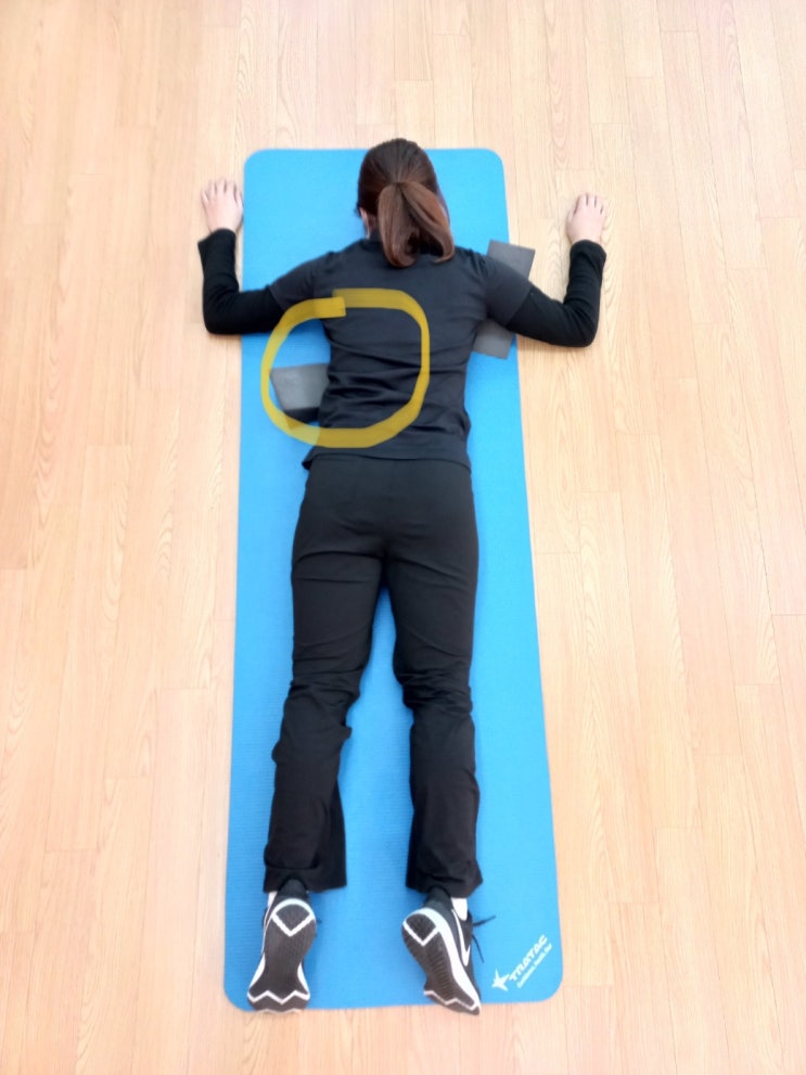 40도 이상 척추측만증 환자의 운동치료의 효과 네이버 블로그