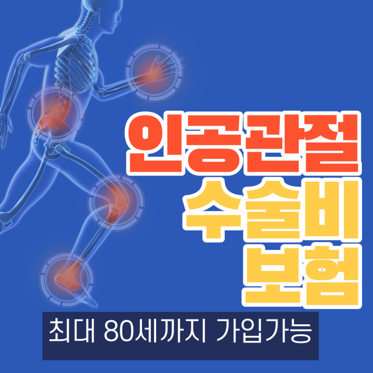 무릎관절염인공관절치환수술비보험607080대세 부모님 자녀 가족을 위한 비갱신형 보험 질병종 네이버 블로그