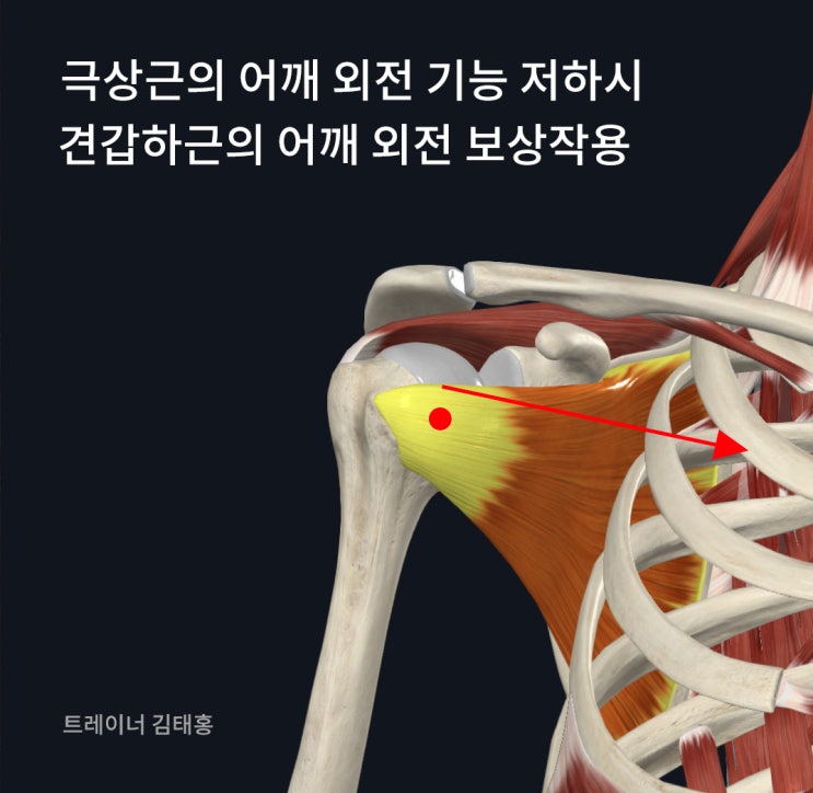 어깨재활 1단계 회전근개 국제휘트니스 교대점 네이버 블로그