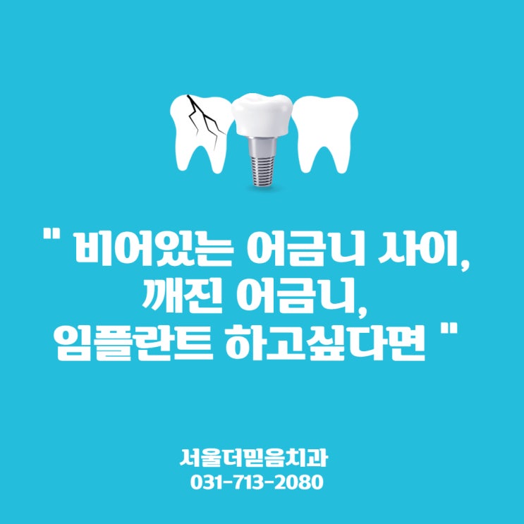 분당치과 임플란트 빠진 치아 방치하면 어떻게 될까요 실제 환자 사례로 살펴 봅시다 미금역치과 잘하는 곳 추천 네이버 블로그