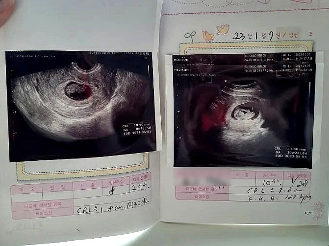 임신 10주차 초음파 및 증상 임밍아웃 근로시간 단축 신청 신청양식 공유 네이버 블로그