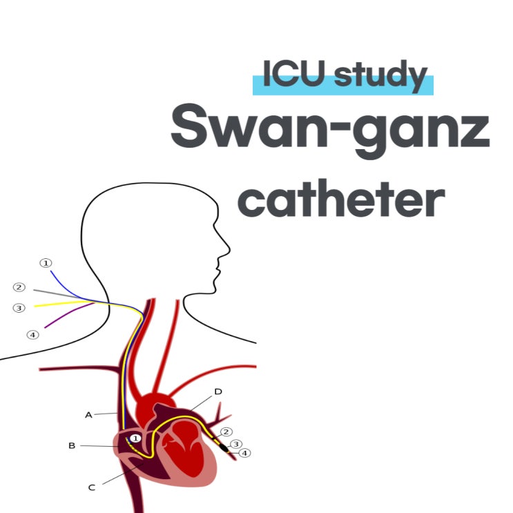 Swan ganz catheter(1) PA(Pulmonary Artery) catheter란, 심장의 구조와 PAC의 4가지 ...