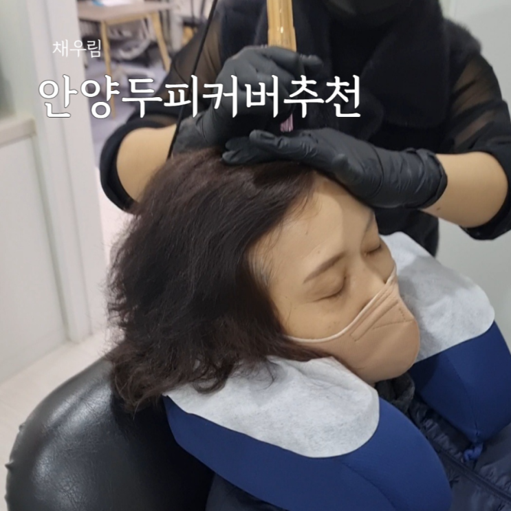 안양두피커버수강 채우림에서 여자정수리 탈모커버 하고 왔어요 네이버 블로그