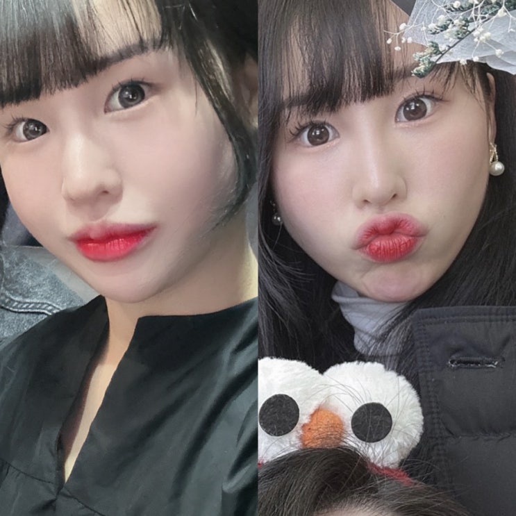 강남역피부과 심부볼 투턱 이중턱소멸패키지 인모드fx 튠라이너 V핏 주사 맞아본 후기 네이버 블로그