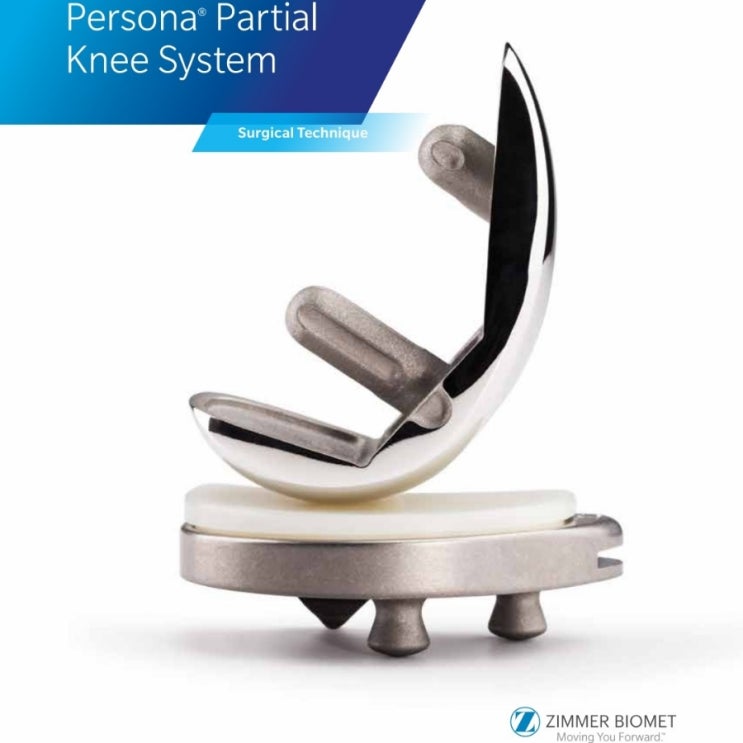 Zimmer) persona partial knee system, uni-TKR : 네이버 블로그