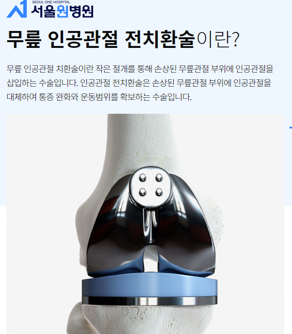 Tkr1 무릎인공관절치환술 궁금증 해결 합리적인 비용 높은 의료서비스 네이버 블로그