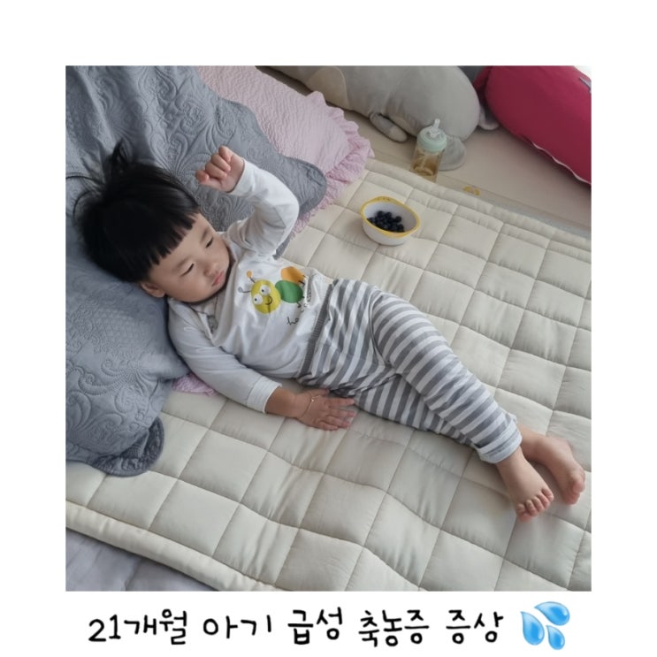 21개월 아기 급성 축농증 부비동염 증상 및 완화 방법 네이버 블로그