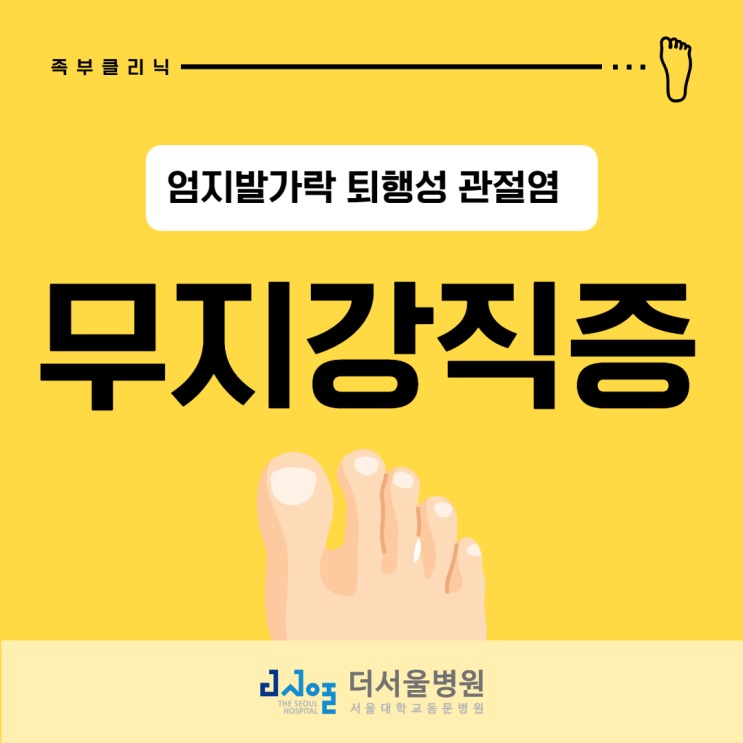 강북 정형외과, 엄지발가락 퇴행성 관절염 '무지강직증' : 네이버 블로그