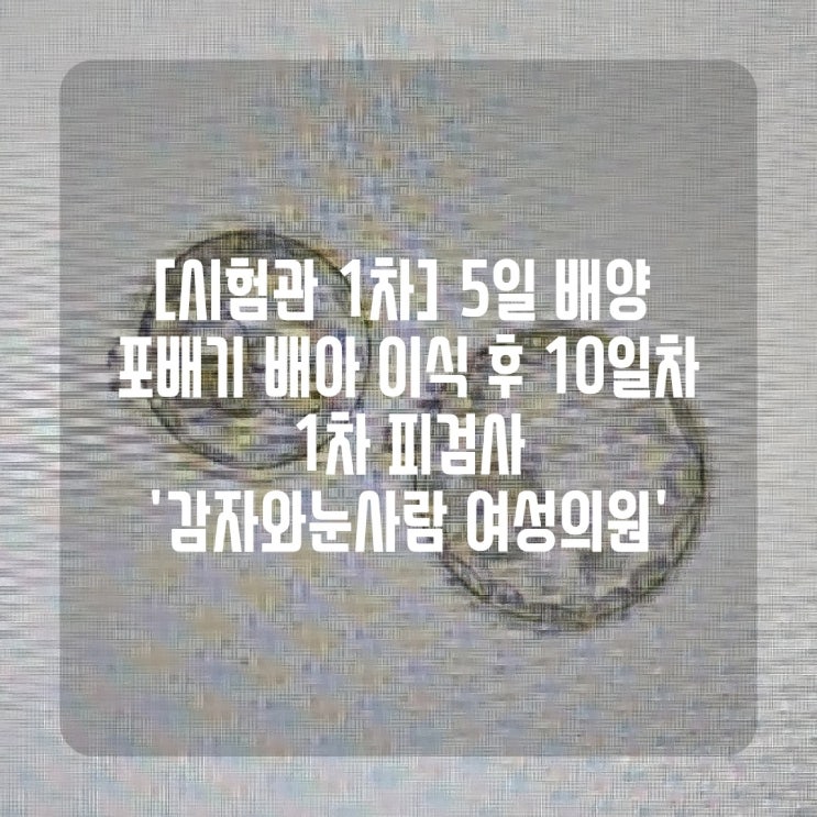 시험관 1차 5일 배양 포배기 배아 신선 이식 1차 피검사 감자와눈사람 여섯 번째 진료 감눈 10일차 임테기