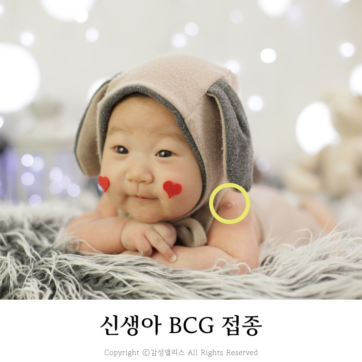 신생아 예방접종 신생아bcg접종 Bcg경피용피내용 어떤걸로f 보건소예방접종 네이버 블로그