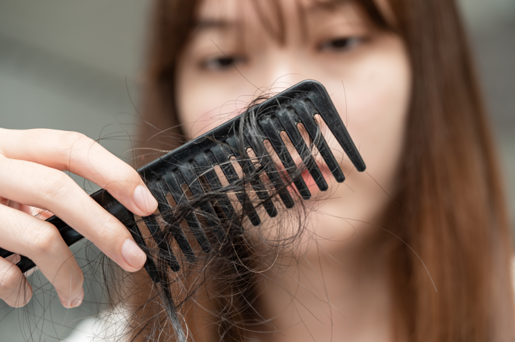 초기 스트레스성 탈모 원인 증상 맥주효모 비오틴 효과 손톱갈라짐 관리 방법 네이버 블로그