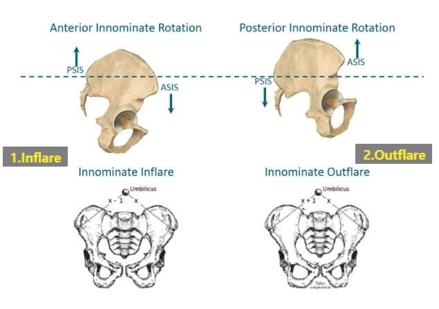 🍑힙업과 힙키우기, 똑같이 운동하면 될까 -1편 골반🍑[버트짐] : 네이버 블로그