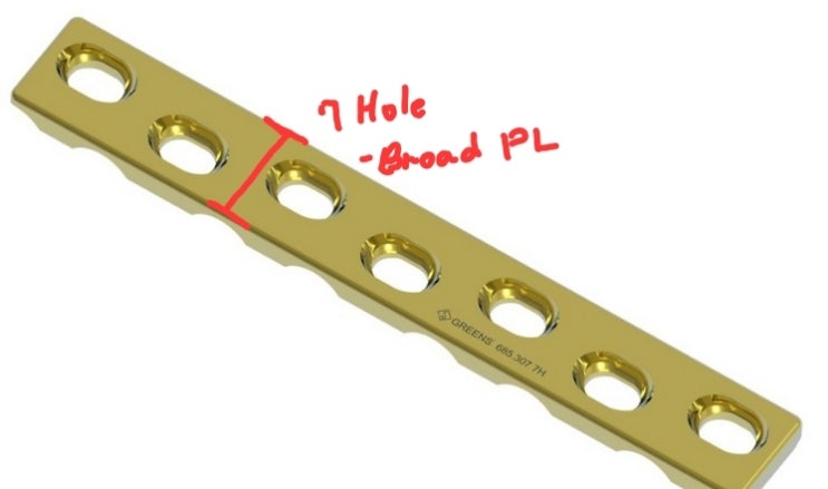 정형외과 기본- narrow plate vs Broad plate 비교 : 네이버 블로그