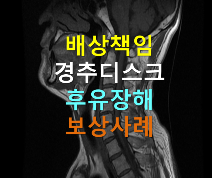영업배상책임 낙상사고 추간판탈출증 후유장해 보상사례 네이버 블로그