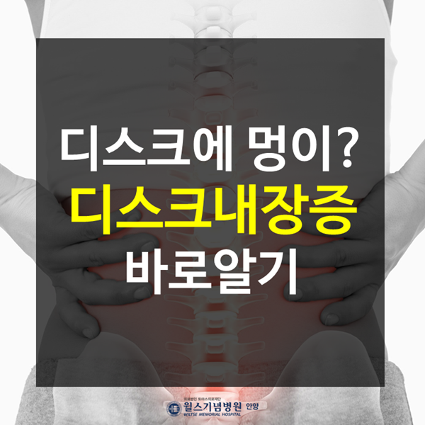 안양척추전문병원 허리 통증 계속 된다면 혹시 디스크내장증│안양윌스기념병원 네이버 블로그
