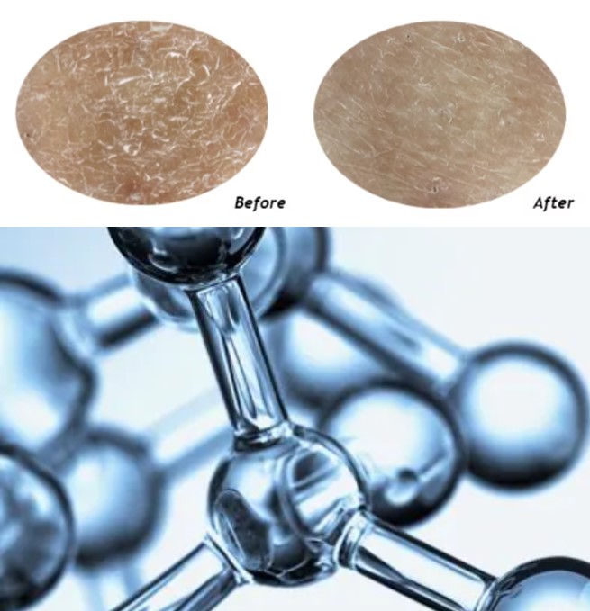 [화장품 성분] Pentavitin® (Saccharide Isomerate, 사카라이드아이소머레이트) : 네이버 블로그