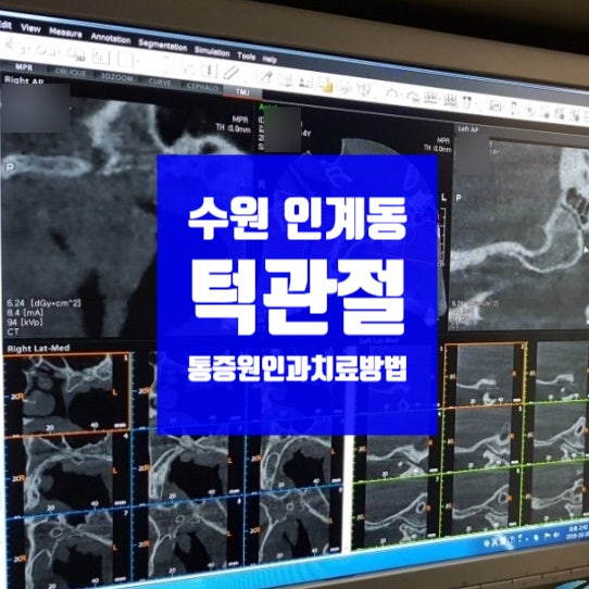 턱통증 턱관절이 안좋을때 원인과 치료방법 네이버 블로그