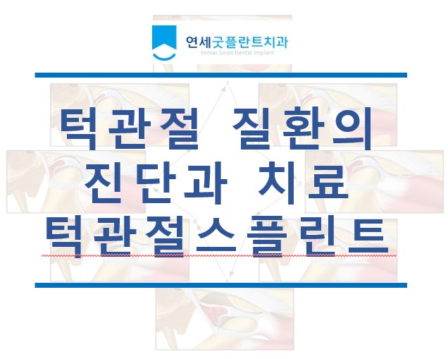 턱에서 소리가 나고 아파요 턱관절 스플린트tmj Splint를 이용한 턱관절 질환의 치료 네이버 블로그