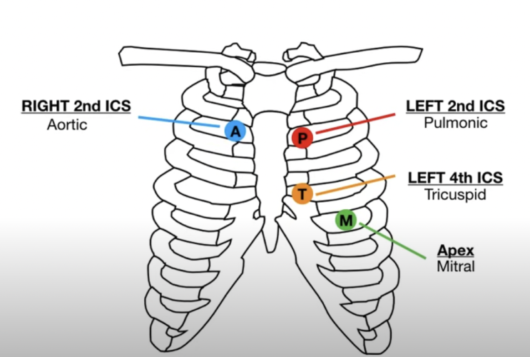 [의학 지식] Heart sound 청진 부위, 의미 및 실제 심장음 청취 가능한 링크 (Rub, Gallop, and ...