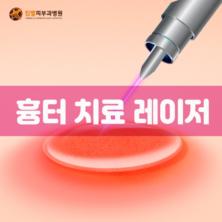 뉴 울트라펄스 앙코르 레이저 대전 흉터 치료 네이버 블로그