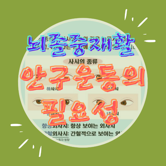 뇌졸중 후유증 사시교정 뇌회복과 재활에도 중요 네이버 블로그