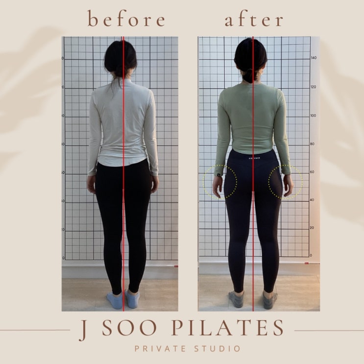 청라 제이수 필라테스 개인레슨 15회차 Before After 청라 물리치료사 원장 직강 청라필라테스 청라체형교정