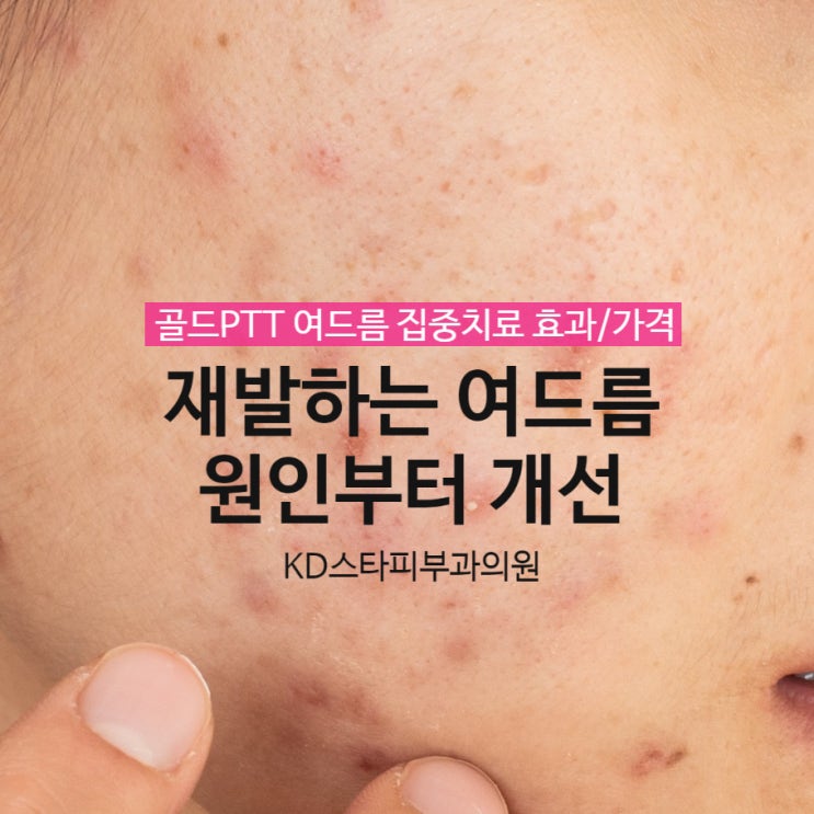 강동구 여드름 치료원인부터 개선하는 골드ptt 효과 가격 네이버 블로그
