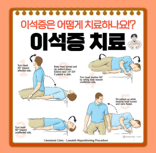 어지럼증의 가장 흔한 질환! (2) - 이석증(BPPV)의 치료 : 네이버 블로그