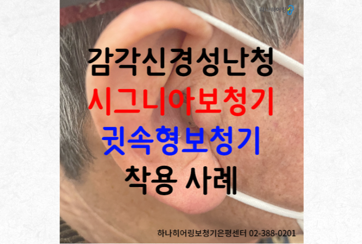 은평구보청기 감각신경성 난청 60대 아버님 시그니아보청기 귓속형 착용 사례 네이버 블로그