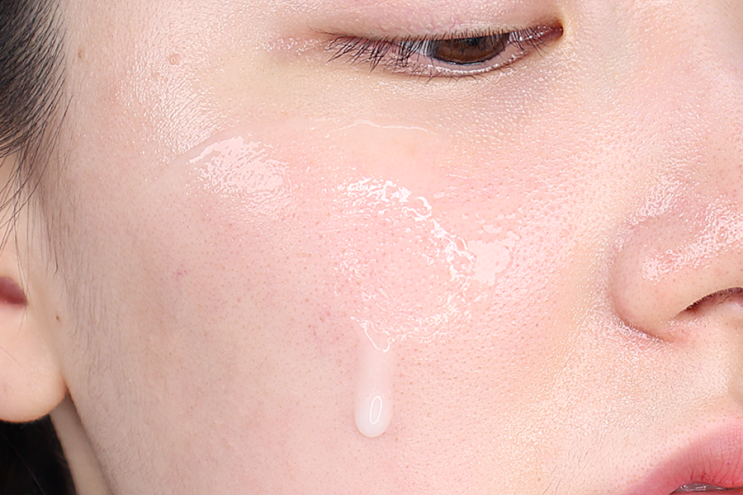 기미 잡티 제거 레이저 안하고 화장품으로 성공 네이버 블로그