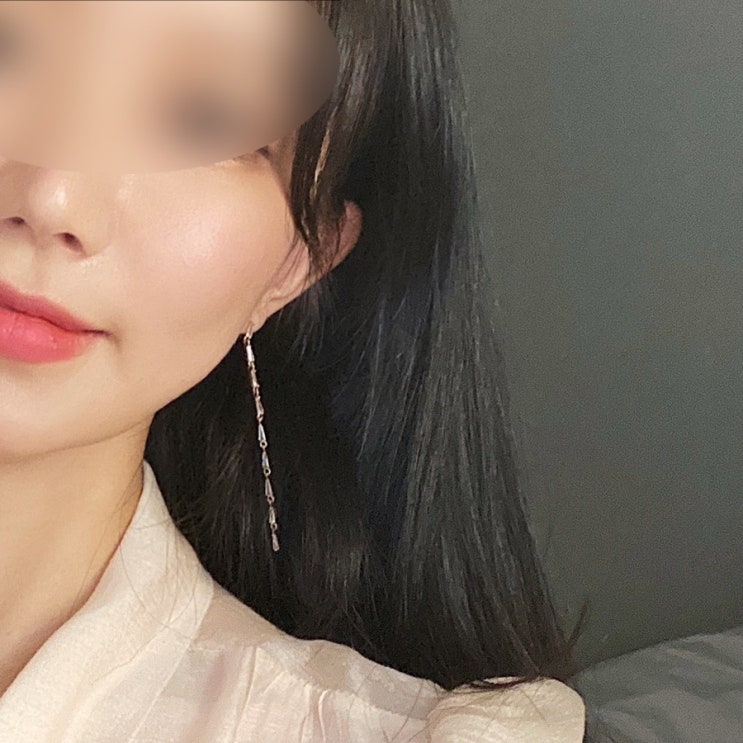 20대 리쥬란힐러 받아본 후기 리쥬란힐러 찐후기 리쥬란힐러 통증 가격 효과 네이버 블로그