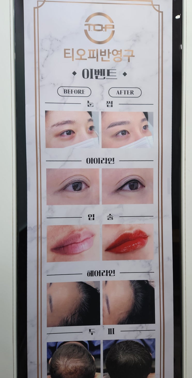 강남 눈썹 탈모 두피 아이라인 잘하는곳 티오피 성형외과 반영구 센터 네이버 블로그