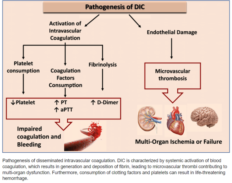 Disseminated intravascular coagulation (DIC, 파종성 혈관내 응고) : 네이버 블로그